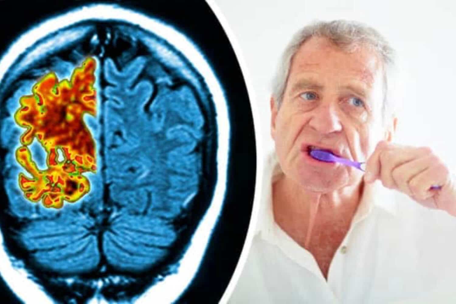 Legătura dintre sănătatea orală, creier și intestine - EDENT Clinic